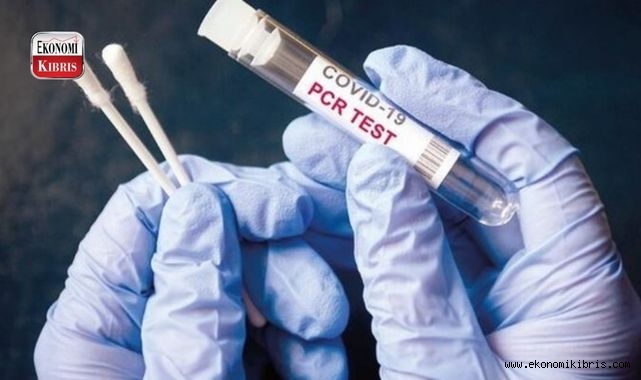 PCR ve Antijen test ücretlerine zam! İşte detaylar... - Kıbrıs ...